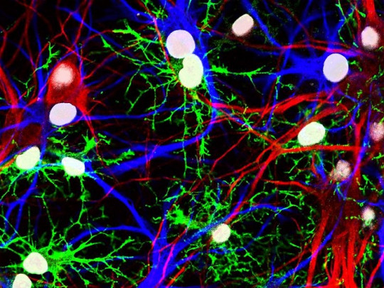 Corteza Entorrinal: FUNCIONES CLAVE del CEREBRO EXPLICADAS