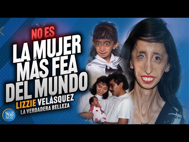 Lizzie Velásquez: La VERDAD sobre la MUJER más fea del MUNDO